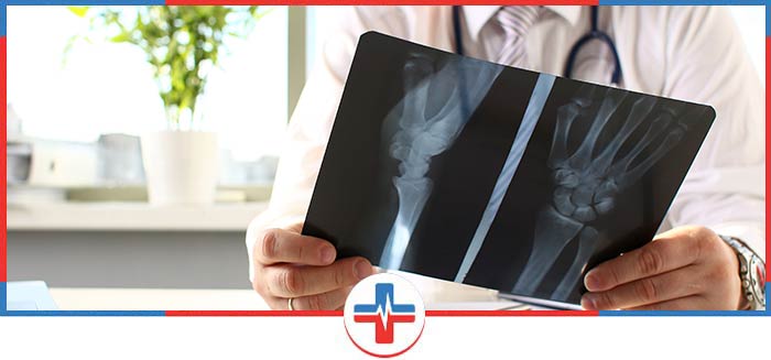 What Are the Benefits of Having an X-Ray at Urgent Care?